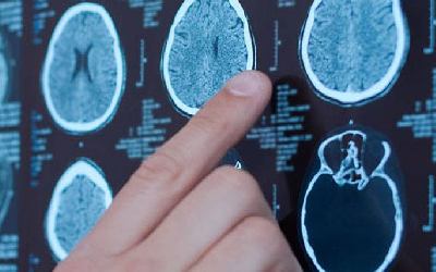 Neurology Institute Abu Dhabi | Harley Street Medical Centre
